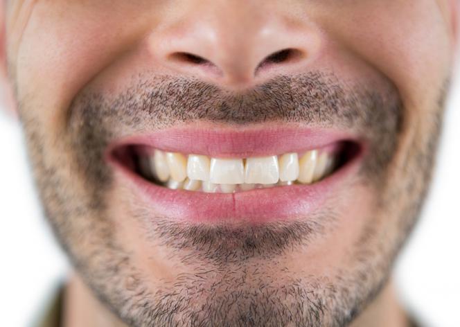 Denti gialli - Cause e rimedi: cosa fare coi denti ingialliti