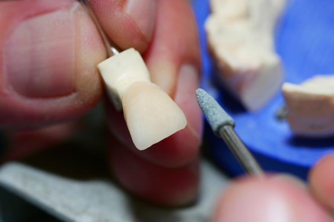 Perno moncone costo, prezzi e informazioni sui materiali