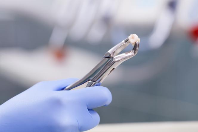 Estrazione radice dente fa male - Ecco che cosa sapere