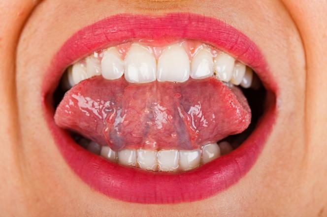 Muscolo genioglosso - Qual è la sua funzione? Tutte le info